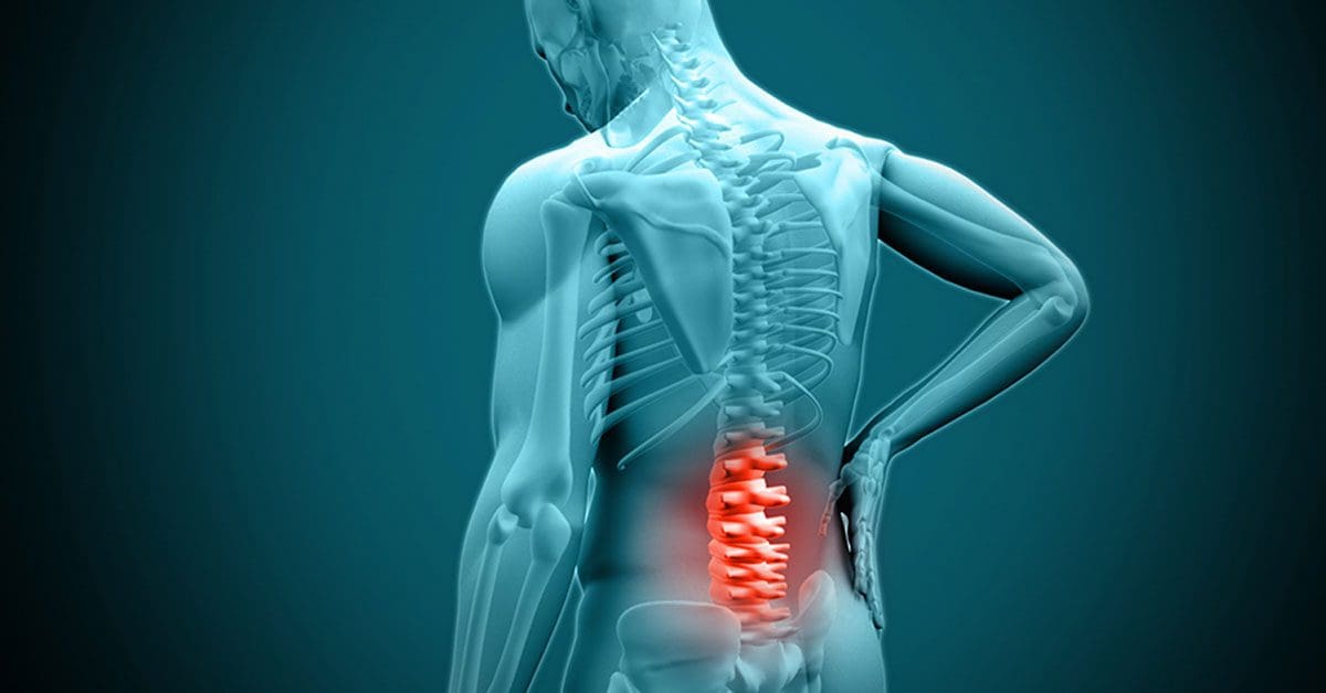 Non-Surgical Spinal Decompression For Chronic Low Back Pain ...