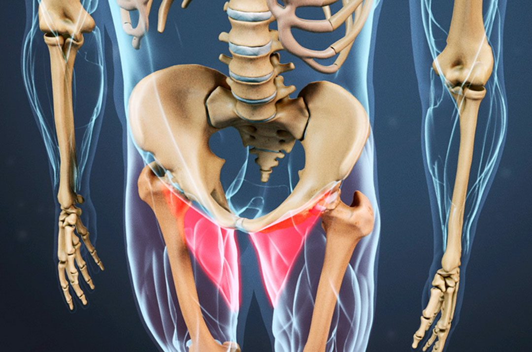 Groin Strain And The Met Technique Integrative Wellness Podcast El Paso Texas